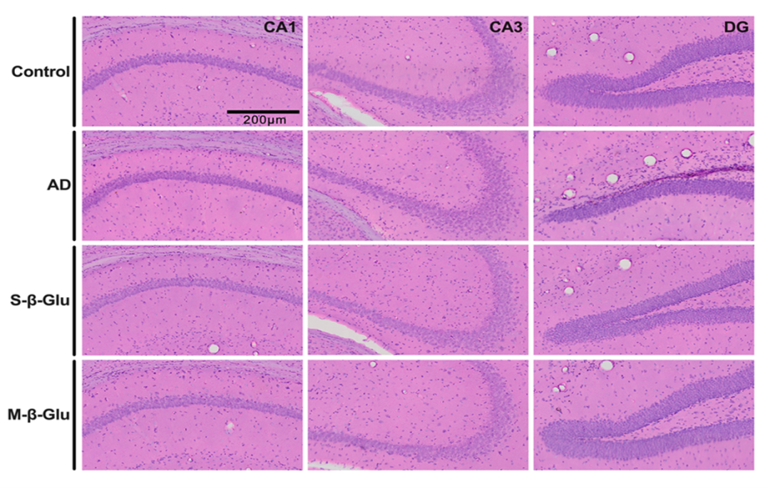 安琪博后出站汇报分享：酵母β-葡聚糖对阿尔茨海默病的保护作用及相关机制研究 - 知乎