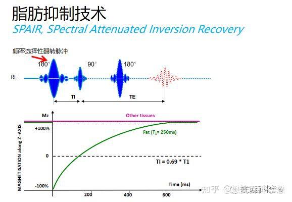 SPAIR序列的TR及TI设置 - 知乎