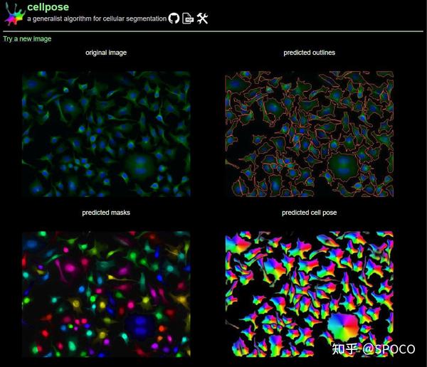 生物图像分割开源工具图鉴（未完待续） - 知乎