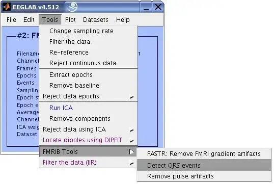 同步脑电-功能磁共振（EEG-FMRI）伪影去除方法及工具箱介绍 - 知乎