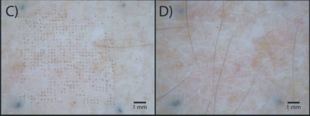 Rox Anderson：从激光医学之父到最成功的医生创业者 - 知乎