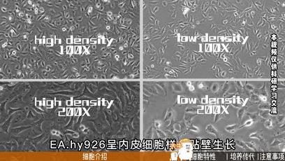 EA.hy926细胞培养，人脐静脉细胞融合细胞培养攻略 - 丰晖生物 - 知乎