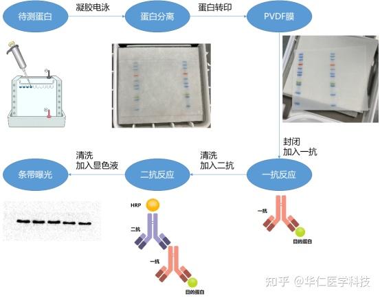 科研小白的进阶之路（1）——Western Blot实验教程 - 知乎