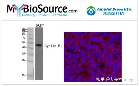 MyBioSource Cyclin E1 多克隆抗体相关研究 - 知乎