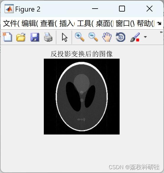 【图像重建】使用FDK的三维谢普洛根幻影重建（Matlab代码实现） - 知乎