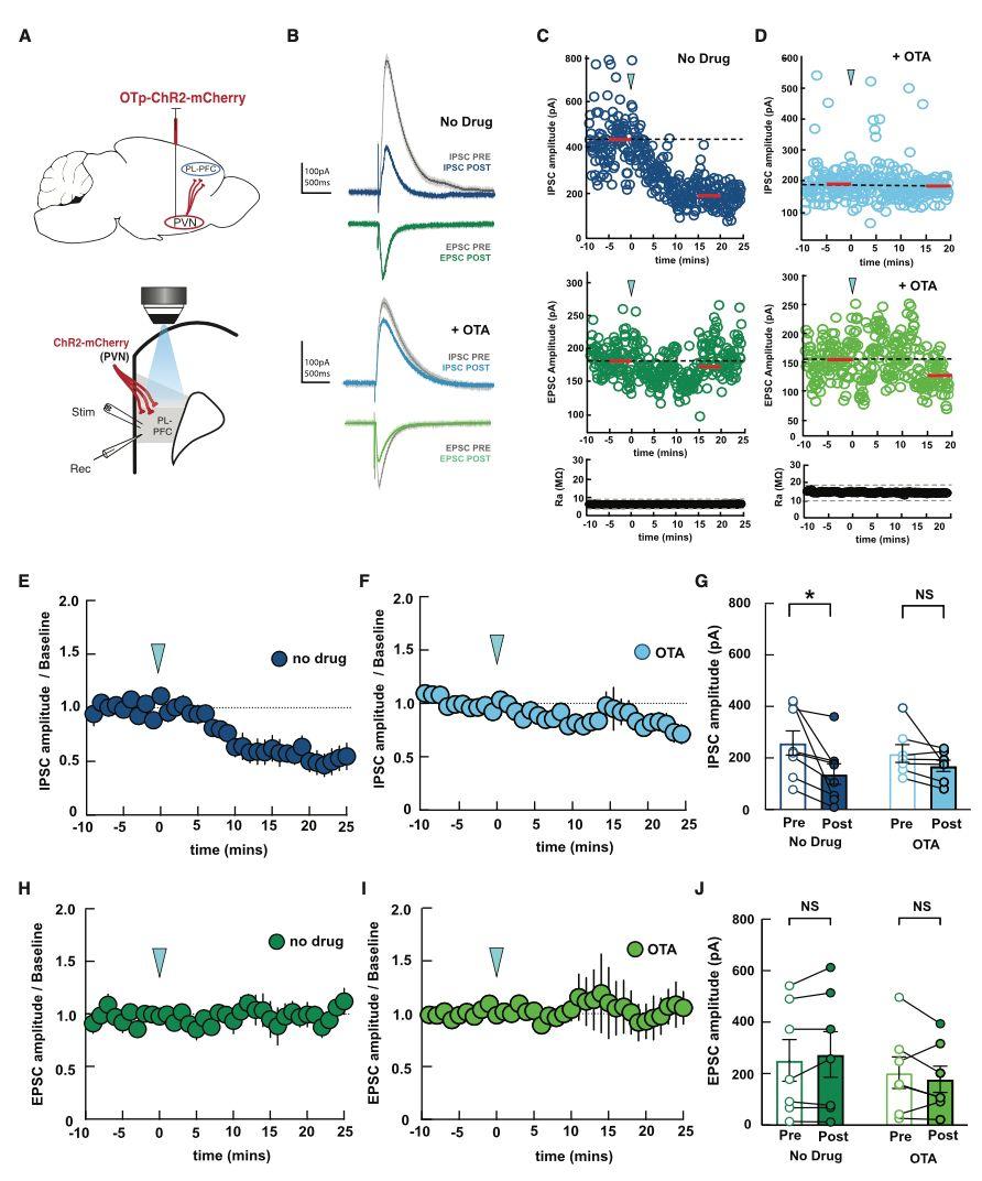 Neuron：催产素镇痛作用的新环路机制 - 知乎