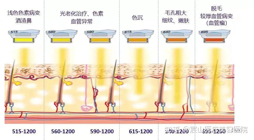 超光子嫩肤单模式vs全模式有啥区别? 知乎