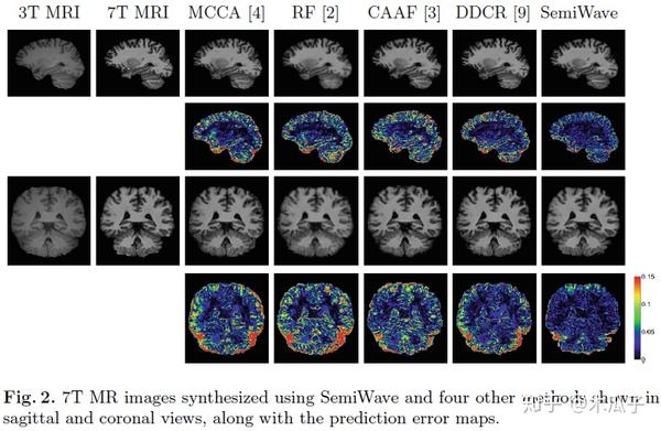 医学图像MRI增强相关论文 - 知乎