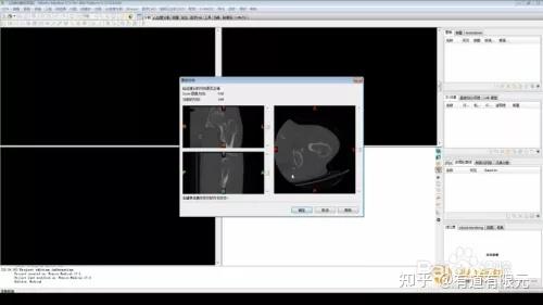 教程-如何用mimics做医学三维模型重建？ - 知乎