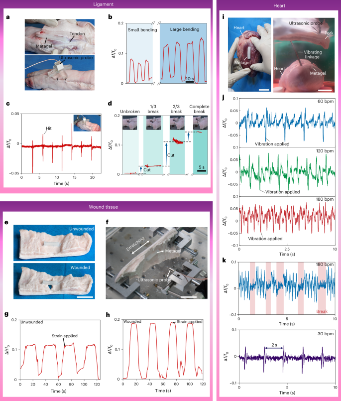 Nature BME | 从“听见”组织的呼吸开始：一种无需芯片的柔性植入式传感器 - 知乎