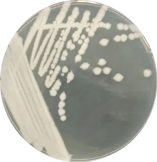 AIculture慧养® | GB 4789.14-2014国标法中蜡样芽胞杆菌的检验步骤分享 - 知乎