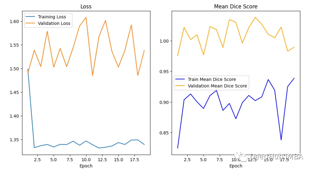 实践教程｜使用Pytorch对MRI脑扫描的图像进行分割 - 知乎