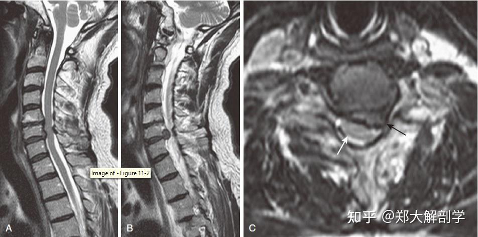C7神经支配区 - 知乎