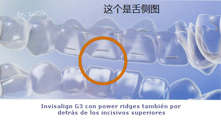 power ridge的使用 - 知乎