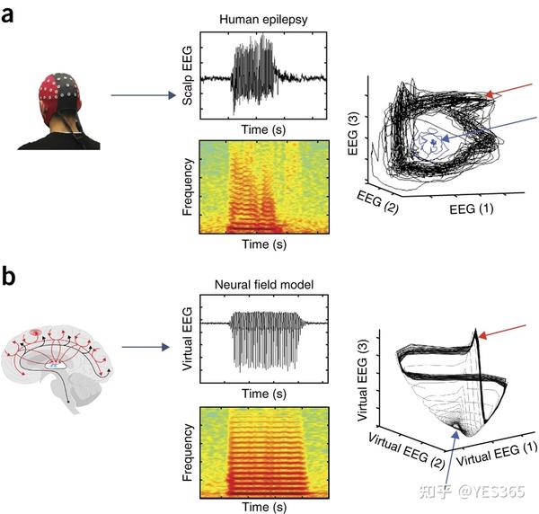 大尺度脑活动的动力学模型 - 知乎