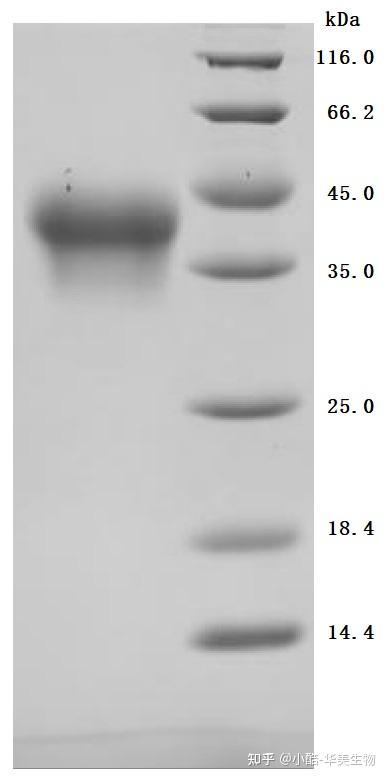 IL2RA(CD25)：CD4+CD25+Tregs亚群最特异性标志物，抑制效应T细胞，免疫领域热点分子！ - 知乎