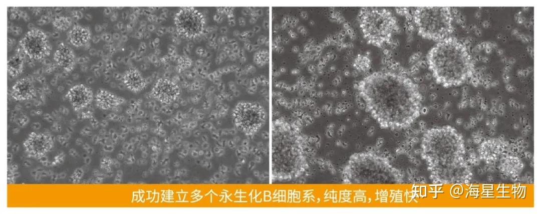 HyCyte®原代细胞预筛选胎牛血清S005—专为原代细胞设计 - 知乎