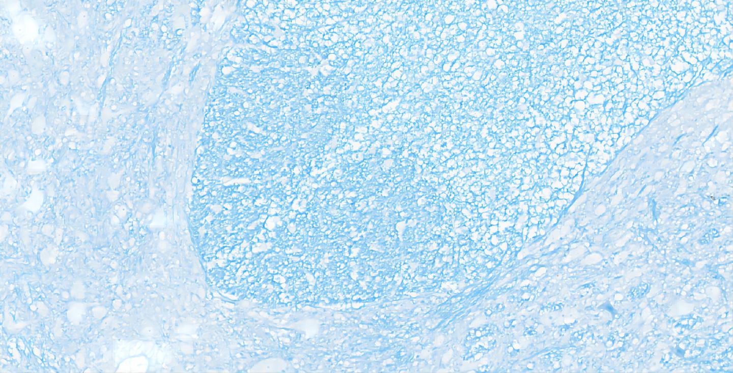 LFB髓鞘染色（步骤及流程） - 知乎