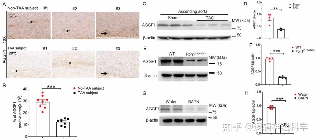 Nat Commun｜华中科技大学王擎课题组发现治疗胸主动脉瘤新策略 - 知乎