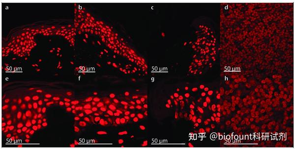 PI（碘化丙啶）；死细胞荧光探针 - 知乎