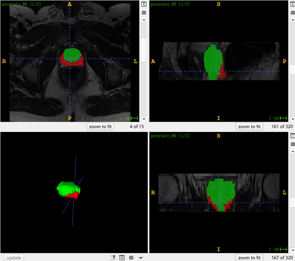 MSD Prostate 数据集介绍 - 知乎