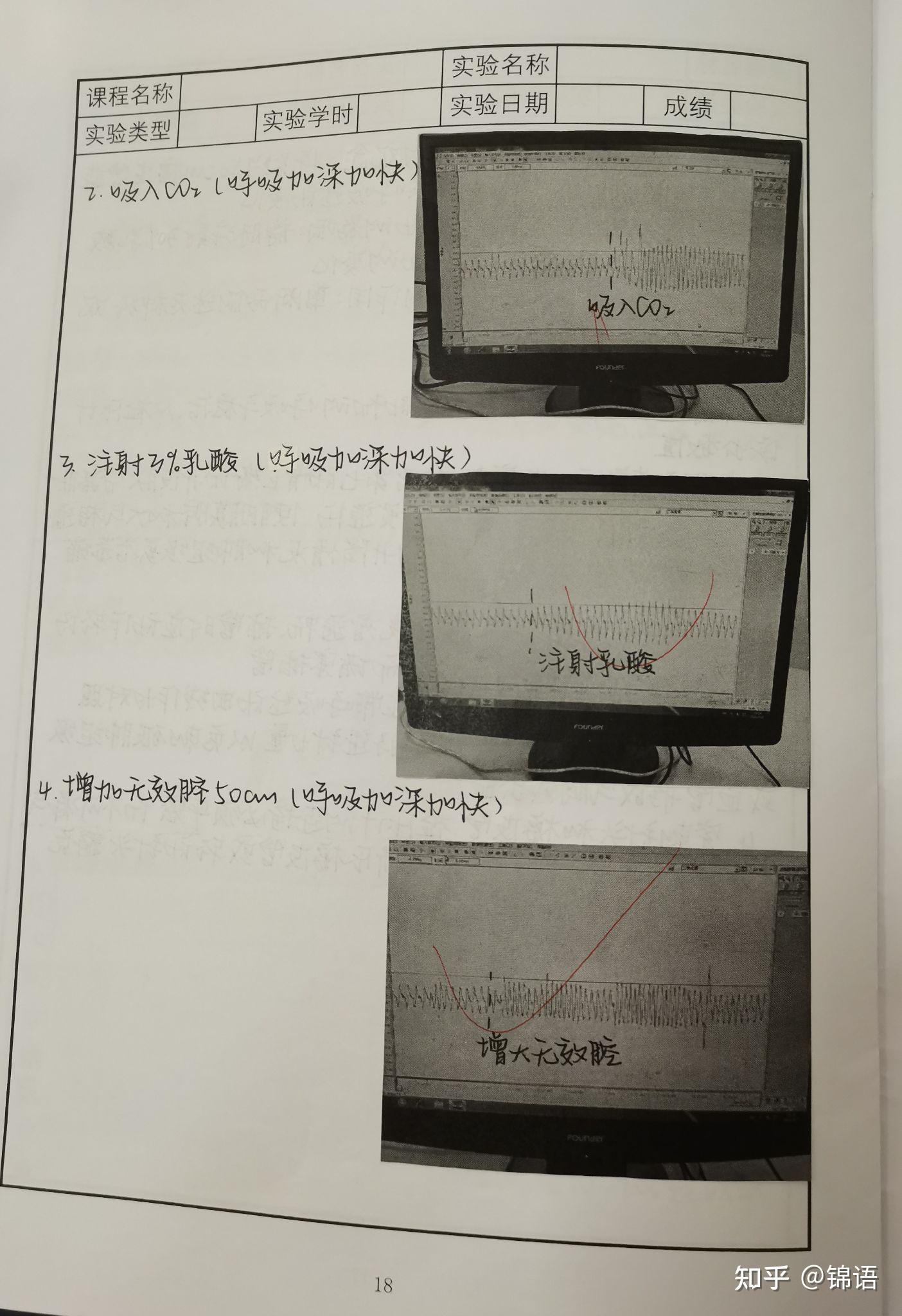 生理学实验—家兔呼吸运动的调节及胸内负压的观察 实验报告册 - 知乎
