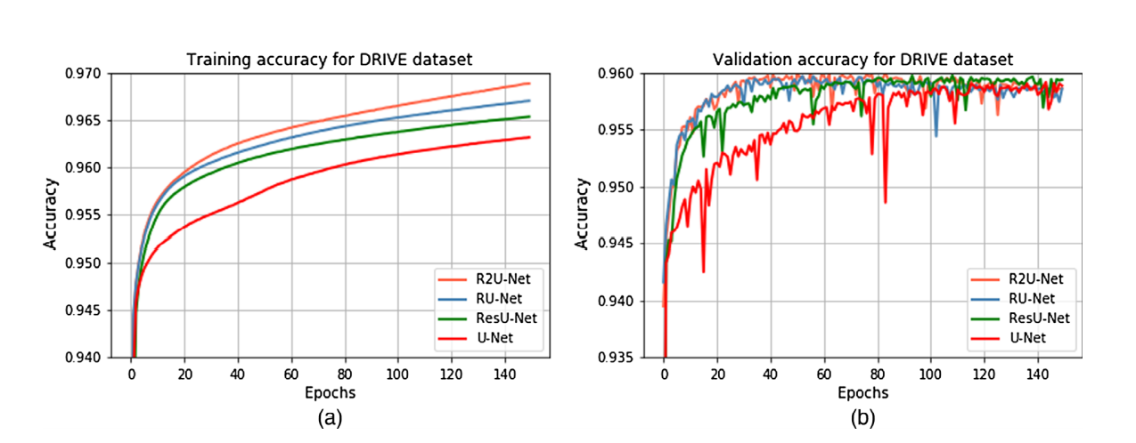 Recurrent residual U-Net for medical（循环残差U-net） - 知乎