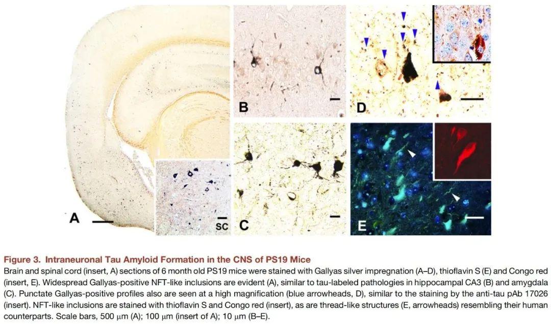 Tau P301S (PS19)小鼠｜AD模型 - 知乎