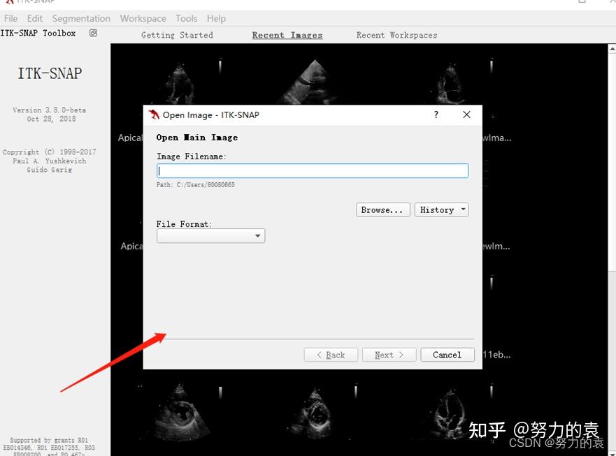 【图像分割】ITK-SNAP分割标注教程 - 知乎