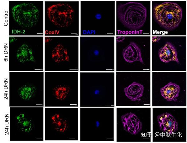 Nat Community：线粒体三羧酸循环脱氢酶迁移到细胞核中可保护心脏细胞免受化疗损伤 - 知乎