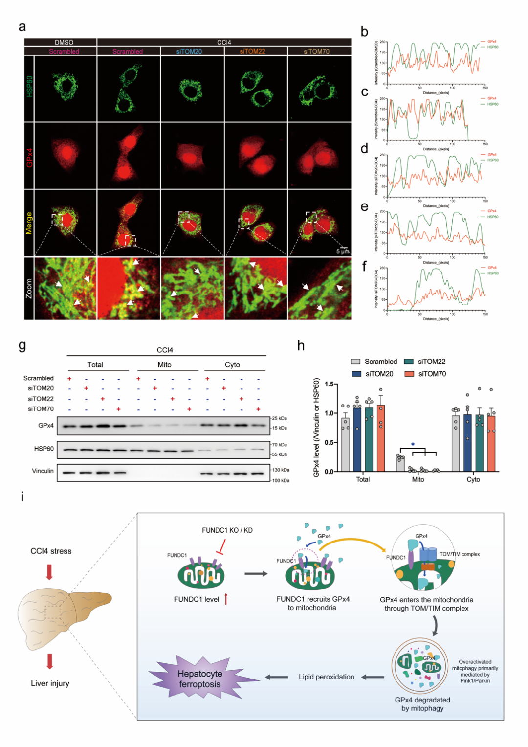 J Adv Res｜复旦大学中山医院团队阐述肝纤维化过程中线粒体自噬调控铁死亡的新机制 - 知乎