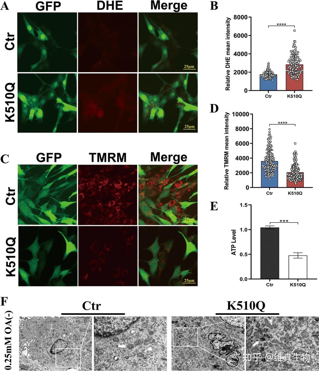 渐冻症研究新进展——FUS基因突变导致骨骼肌脂代谢紊乱！ - 知乎