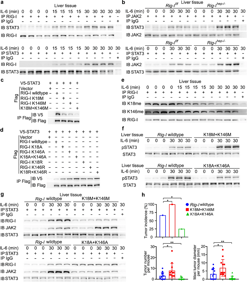 Hematol Oncol丨海军军医大学侯晋/曹雪涛团队解析RIG-I在肝癌发生中的作用 - 知乎