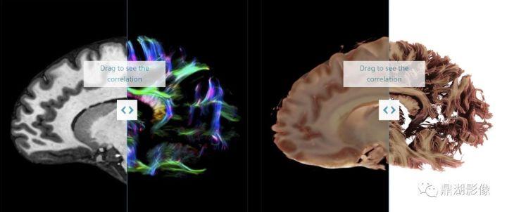 重大突破！临床磁共振进入7T时代！ - 知乎