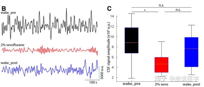 BOLD-CSF coupling：人脑血液动力学与脑脊液振荡耦合技术原理与应用 - 知乎