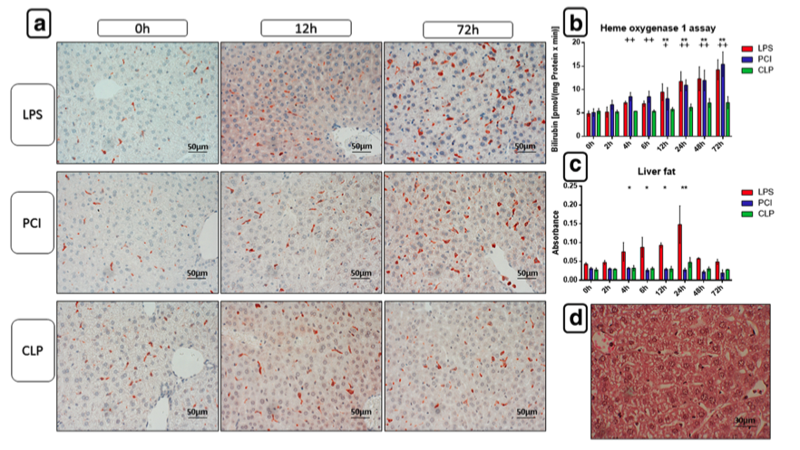 JBS丨三种脓毒症模型的效果详细对比 CLP？LPS？PCI？ - 知乎