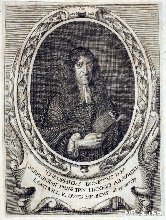 泌尿传奇：尿路结石的历史71 - 知乎