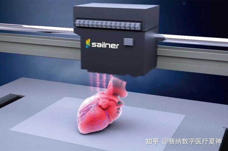 医疗3D建模打印在心血管外科的应用 - 知乎