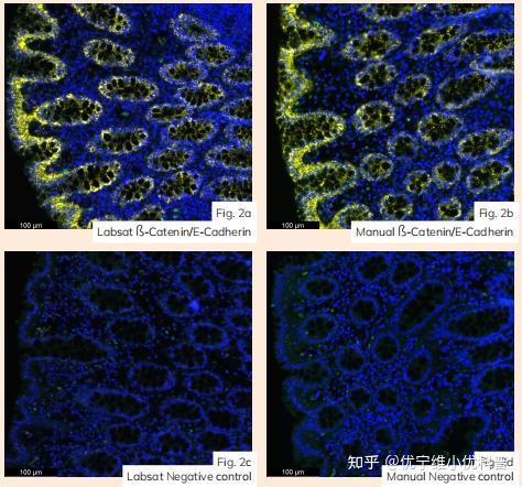 小优进修班∣Naveni® PLA产品效果展示 - 知乎