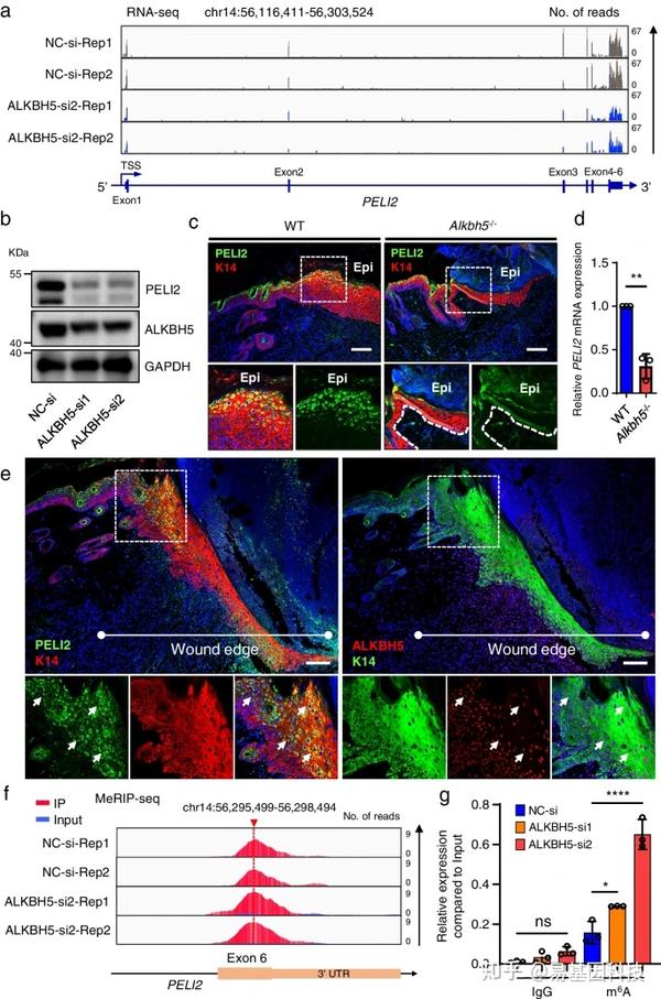 易基因：MeRIP-seq等揭示ALKBH5介导m6A去甲基化调控皮肤创面再上皮化分子机制｜科研进展 - 知乎