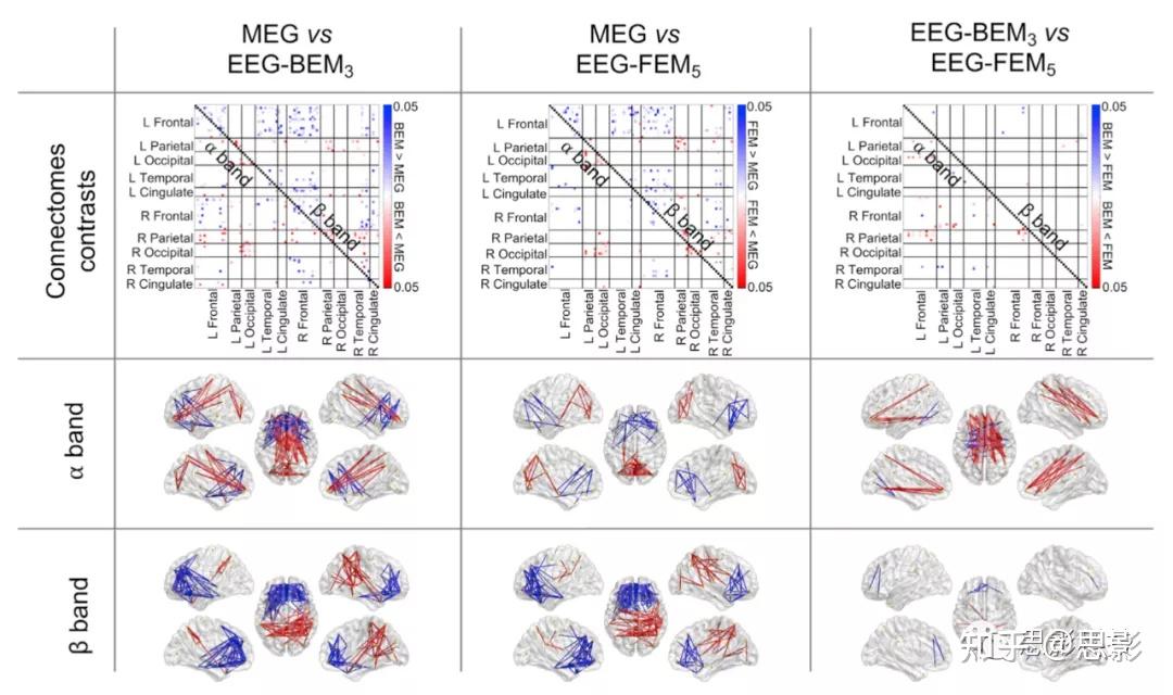 比较脑磁图与高密度脑电图的内在功能连通性 - 知乎