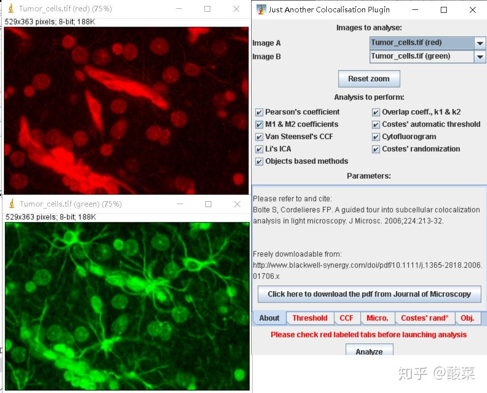 看完这篇，荧光共定位分析就没问题了！ - 知乎