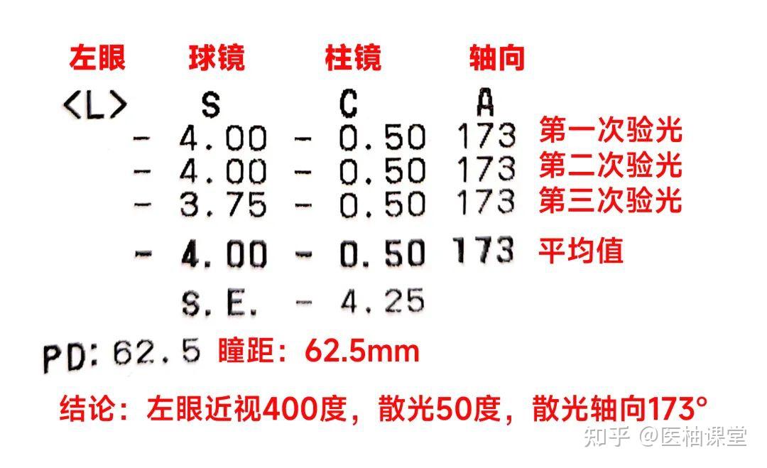 如何读懂验光单 - 知乎