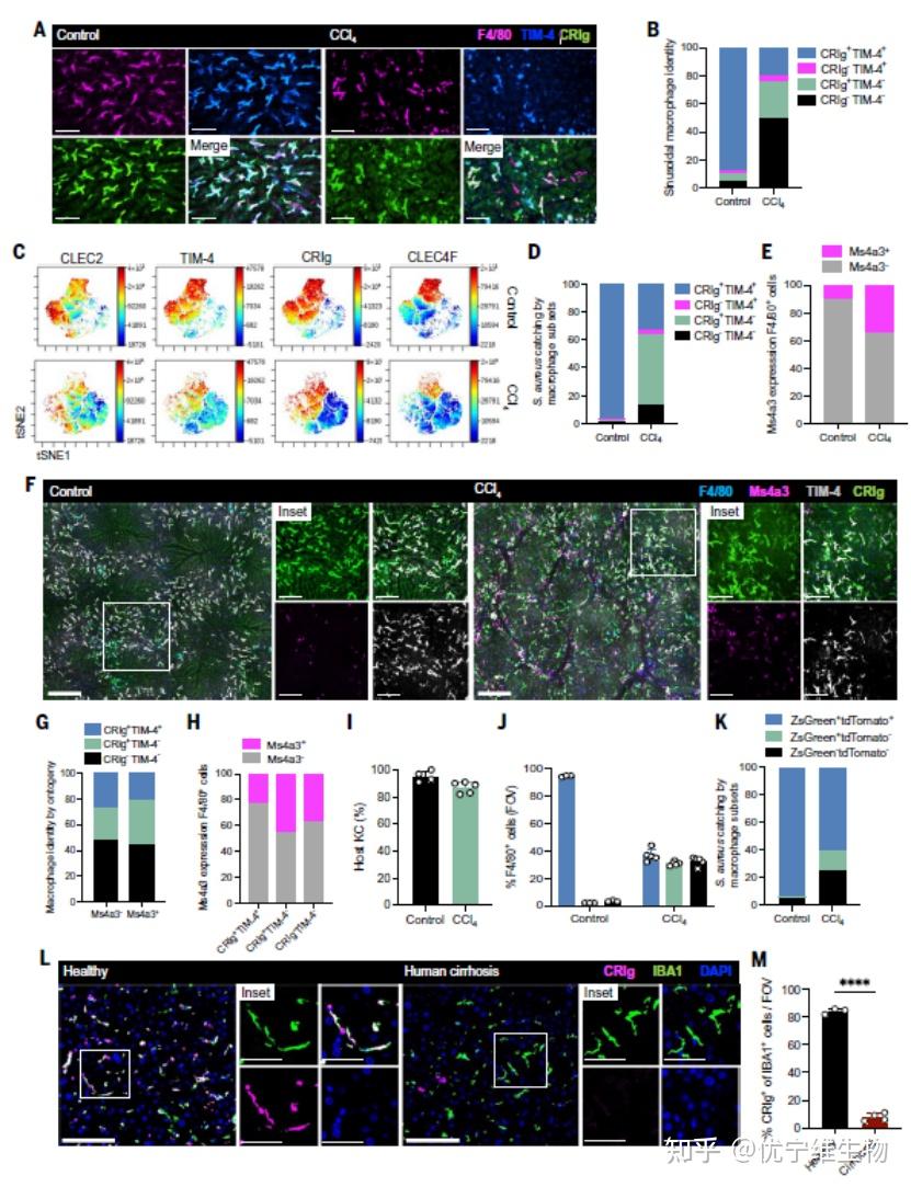 [IF: 56.9] Science揭示巨噬细胞Kupffer的新帮手，原来竟是他？！ - 知乎