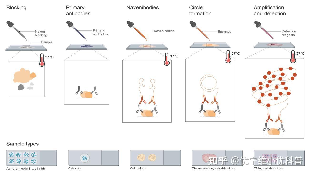小优读文献∣Naveni® PLA技术&现有文献部分解析 - 知乎