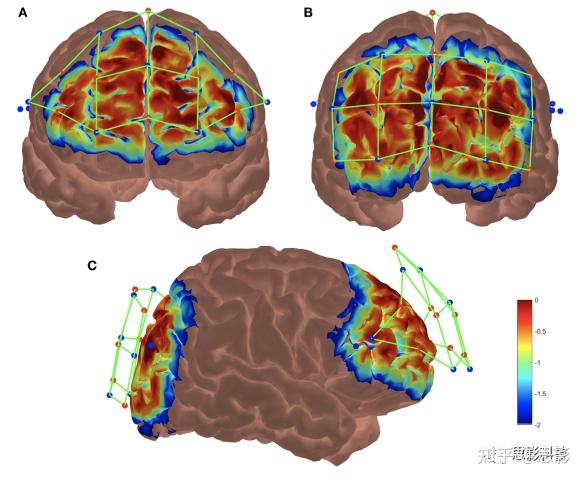 基于fNIRS连接度特征监测飞行员的参与度(自动vs手动驾驶着陆) - 知乎