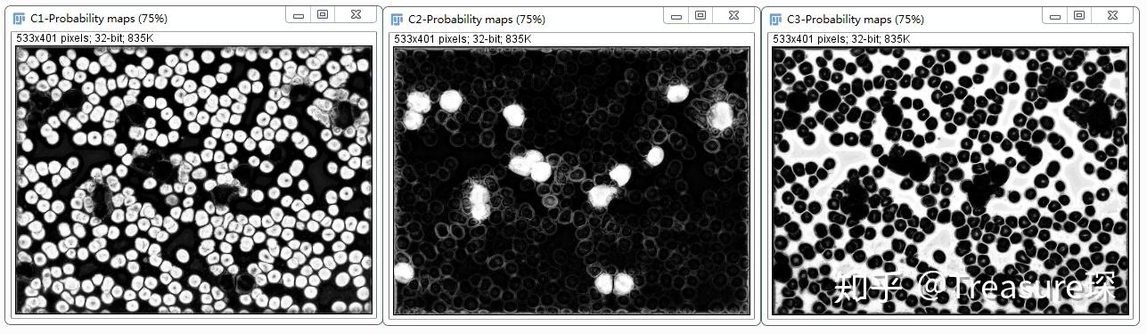 ImageJ实用技巧——基于机器学习的自动细胞分割(插件篇) - 知乎