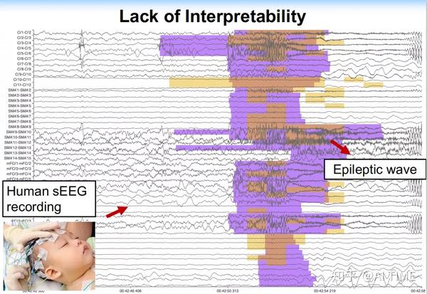 浙江大学副教授杨洋——《Time2Graph：从图视角出发的时间序列建模》 - 知乎