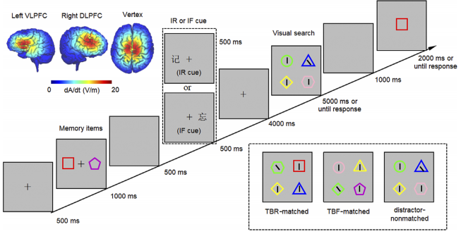 经颅磁刺激左VLPFC或右DLPFC可促进工作记忆中的遗忘 - 知乎