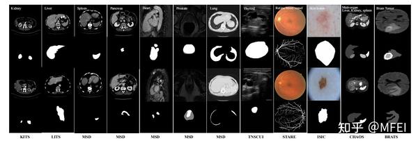 论文精读：Medical Image Segmentation Using Deep Learning：A Survey - 知乎